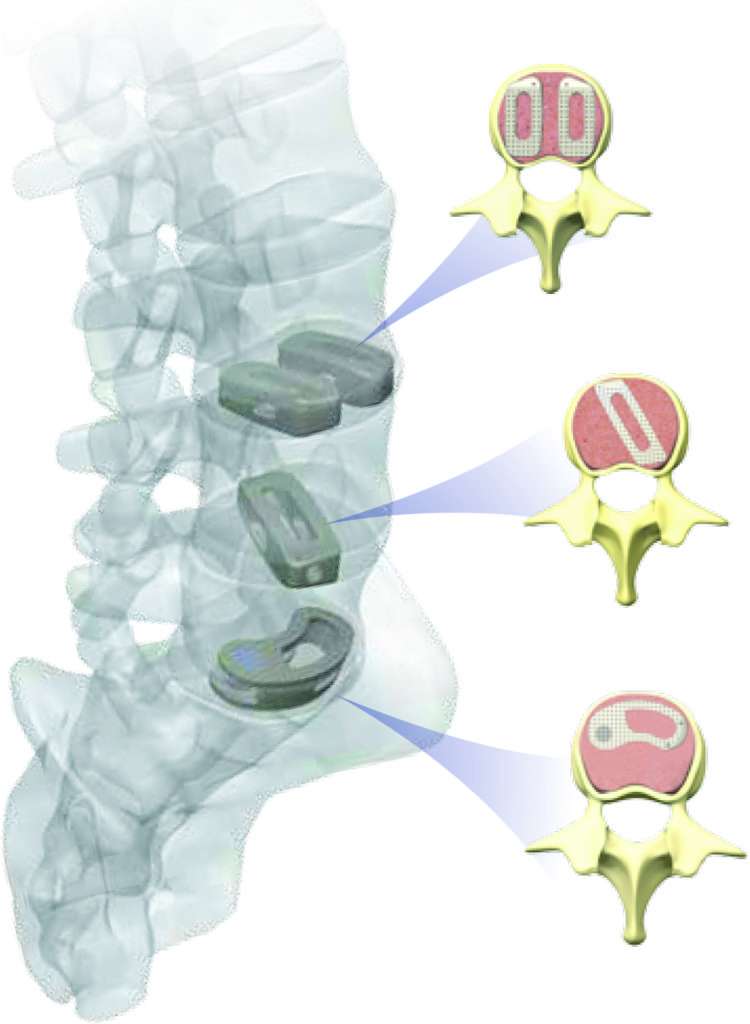 Medacta® for Surgeon - Premier Surgical