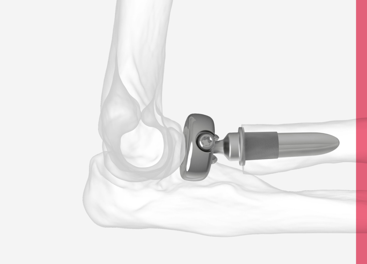 Skeletal Dynamics - Premier Surgical