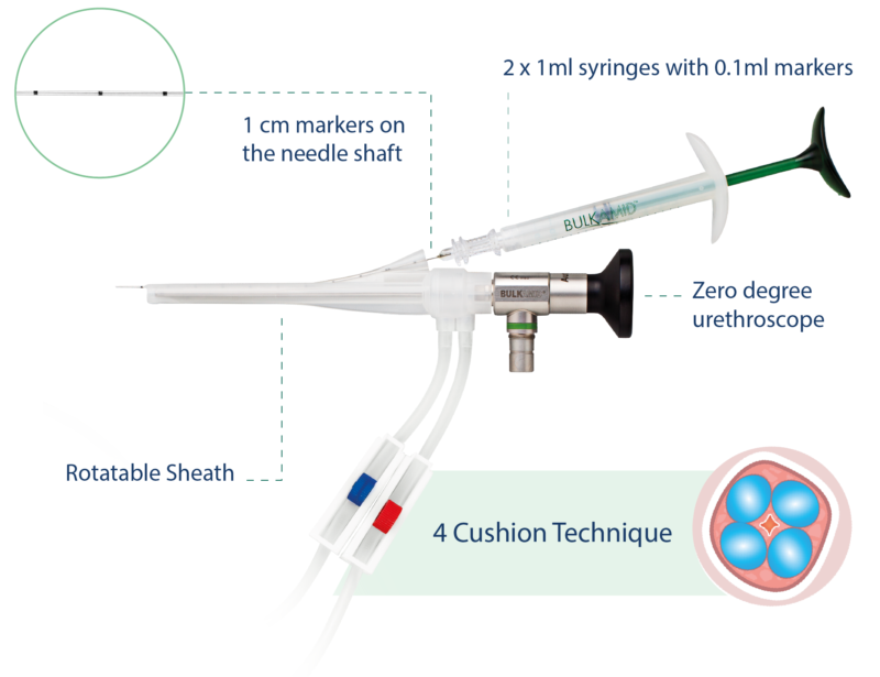 Bulkamid® for Surgeon - Premier Surgical