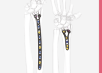 Skeletal Dynamics - Premier Surgical