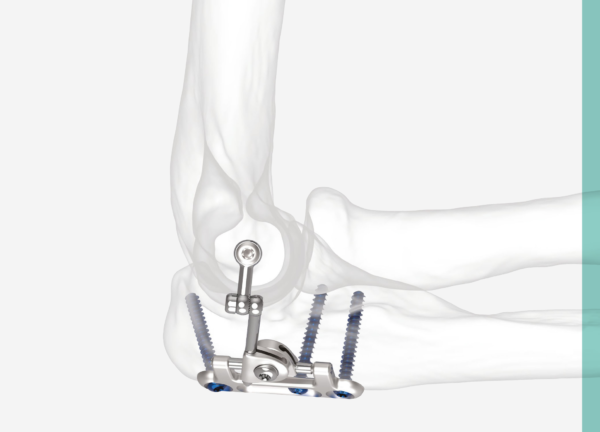 Skeletal Dynamics - Premier Surgical