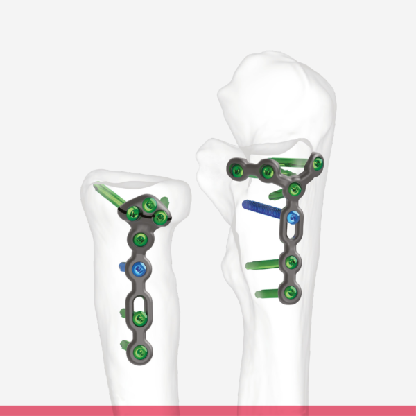 Skeletal Dynamics - Premier Surgical