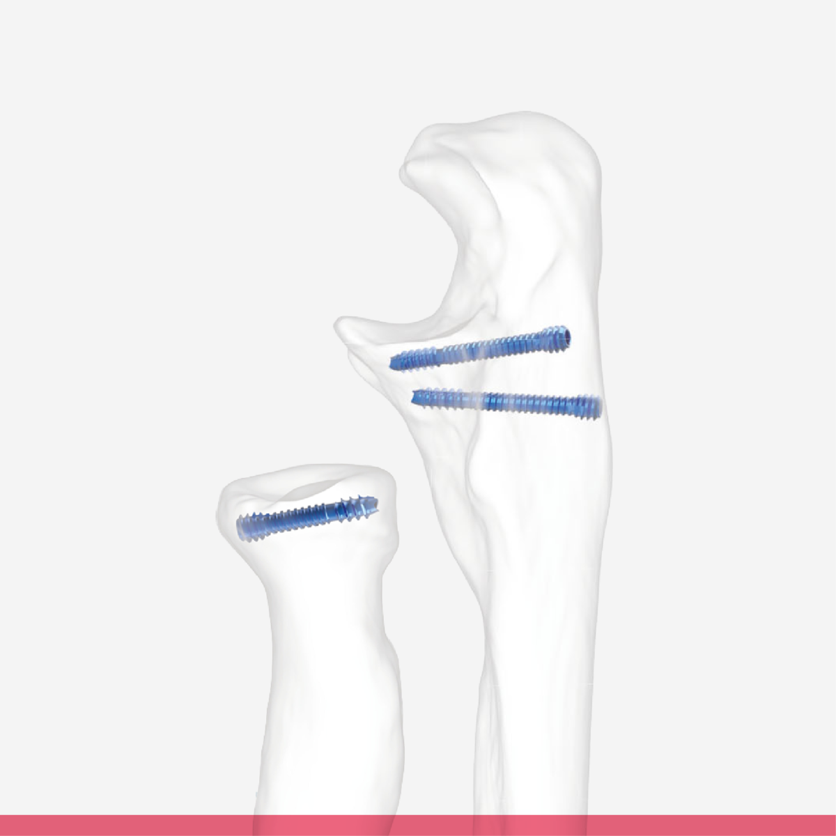 Skeletal Dynamics - Premier Surgical