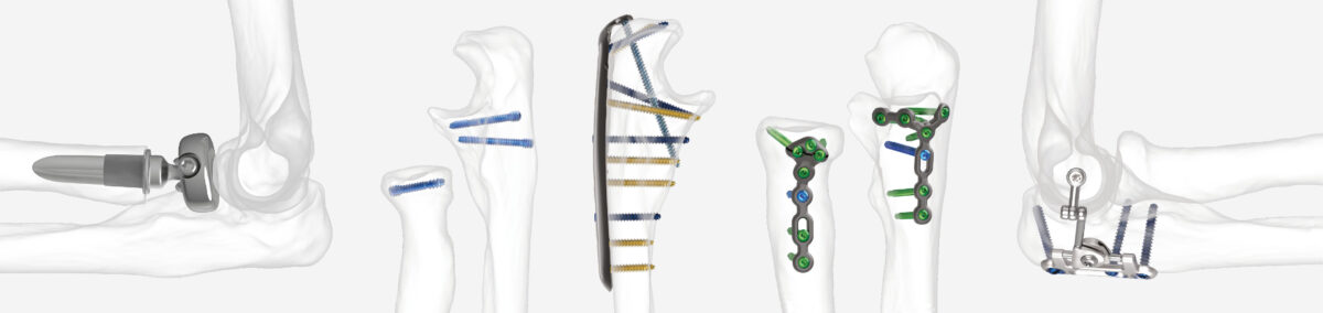Skeletal Dynamics Premier Surgical
