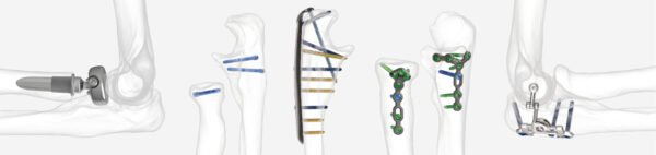 Skeletal Dynamics - Premier Surgical