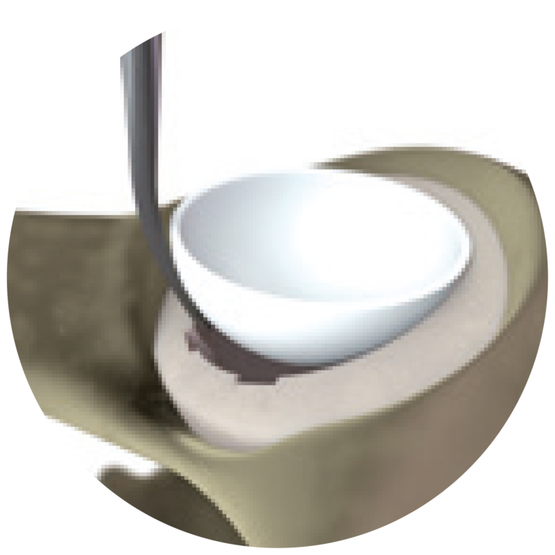 Oscar Pro - Premier Surgical